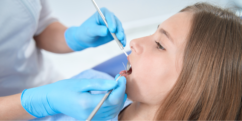 Expert Chipped Tooth Repair San Diego, Rancho Bernardo, Poway